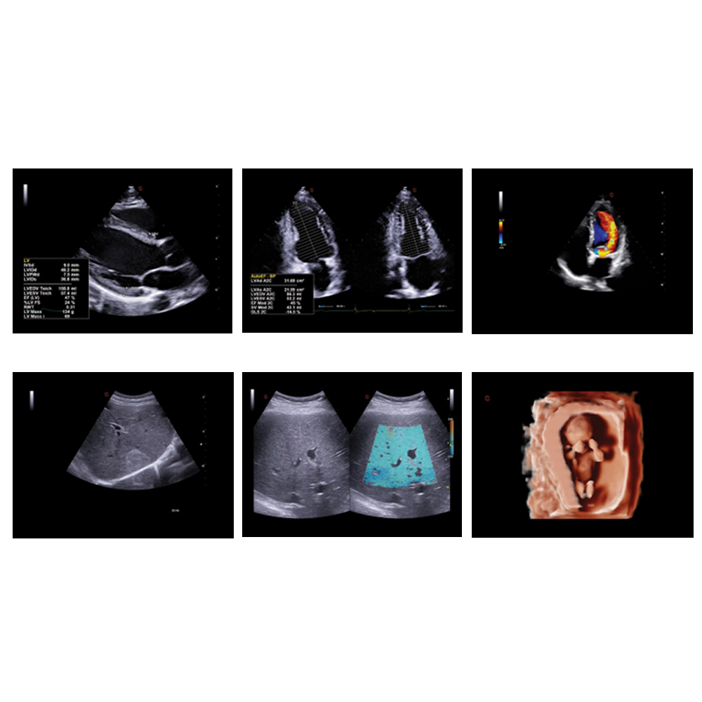 Ecograf MyLab™A70, Esaote - Aparatura Medicala - Distribuitor - Proton ...