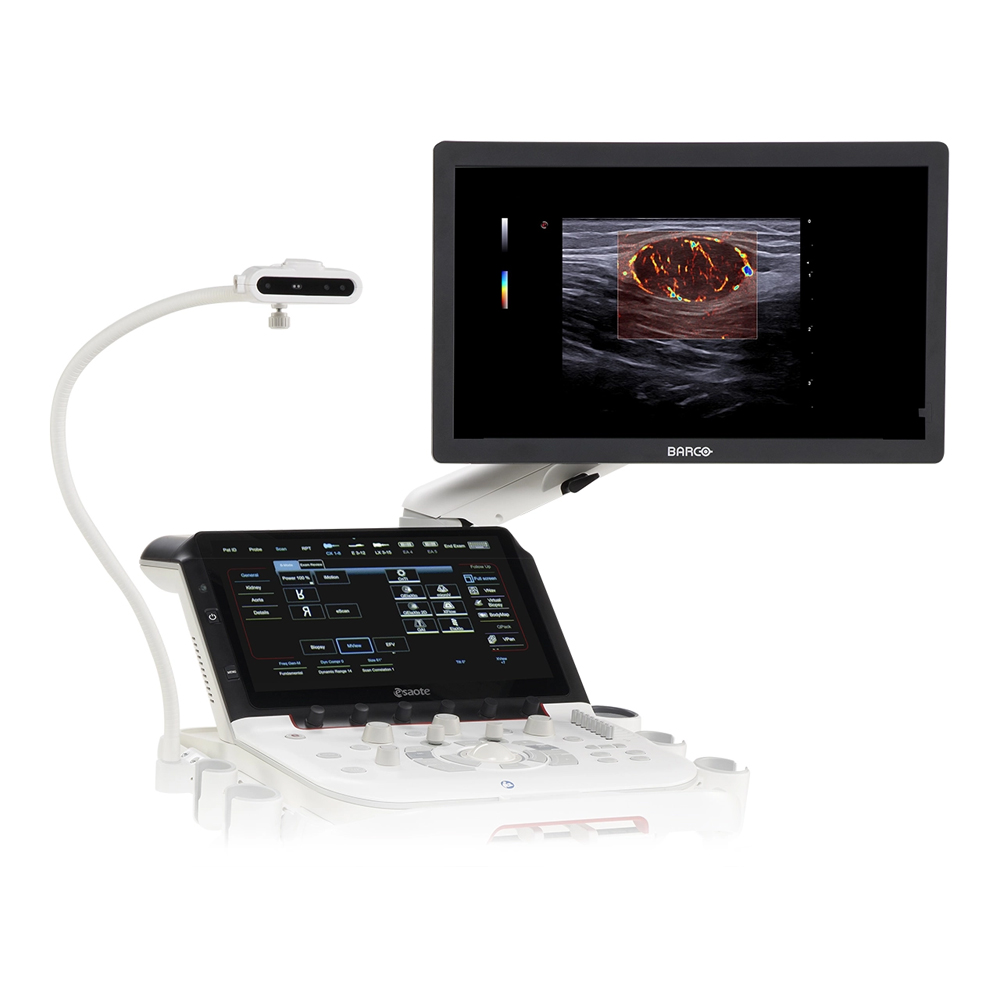 Ecograf MyLab™X90, Esaote - Aparatura Medicala - Distribuitor - Proton ...